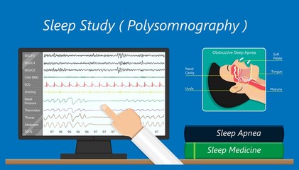 Home Sleep Testing Services | Remedy Sleep
